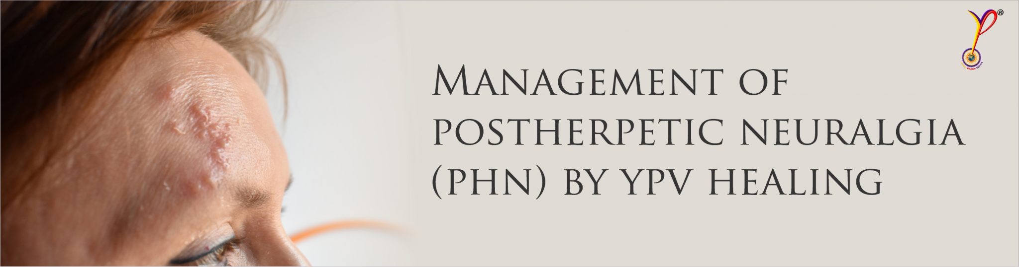 Management of Post-herpetic Neuralgia (PHN) by YPV healing - Yoga Prana Vidya