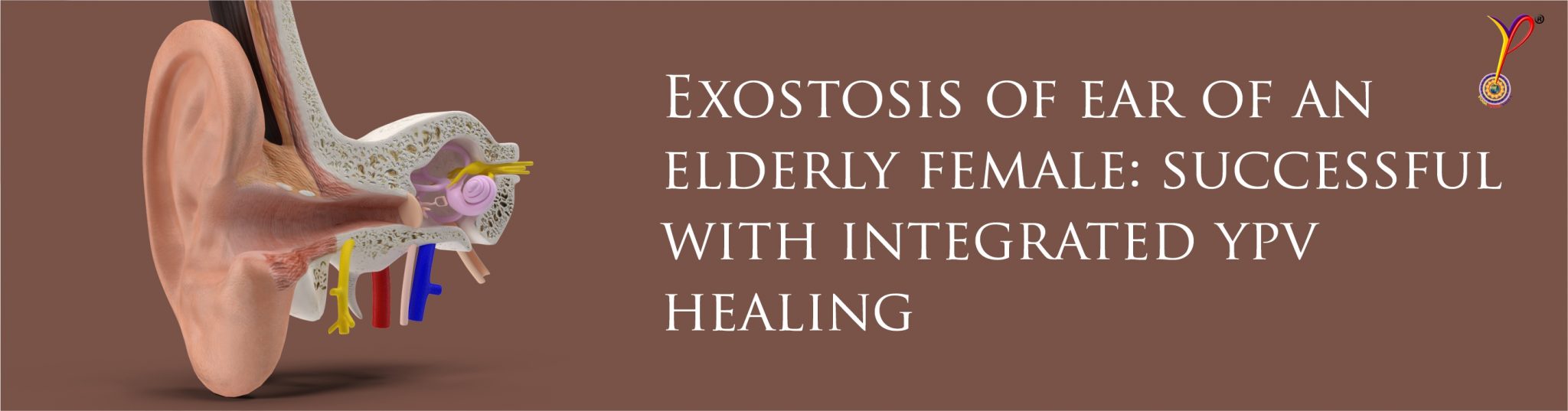 Exostosis of Ear of an elderly female: Successful with Integrated YPV ...
